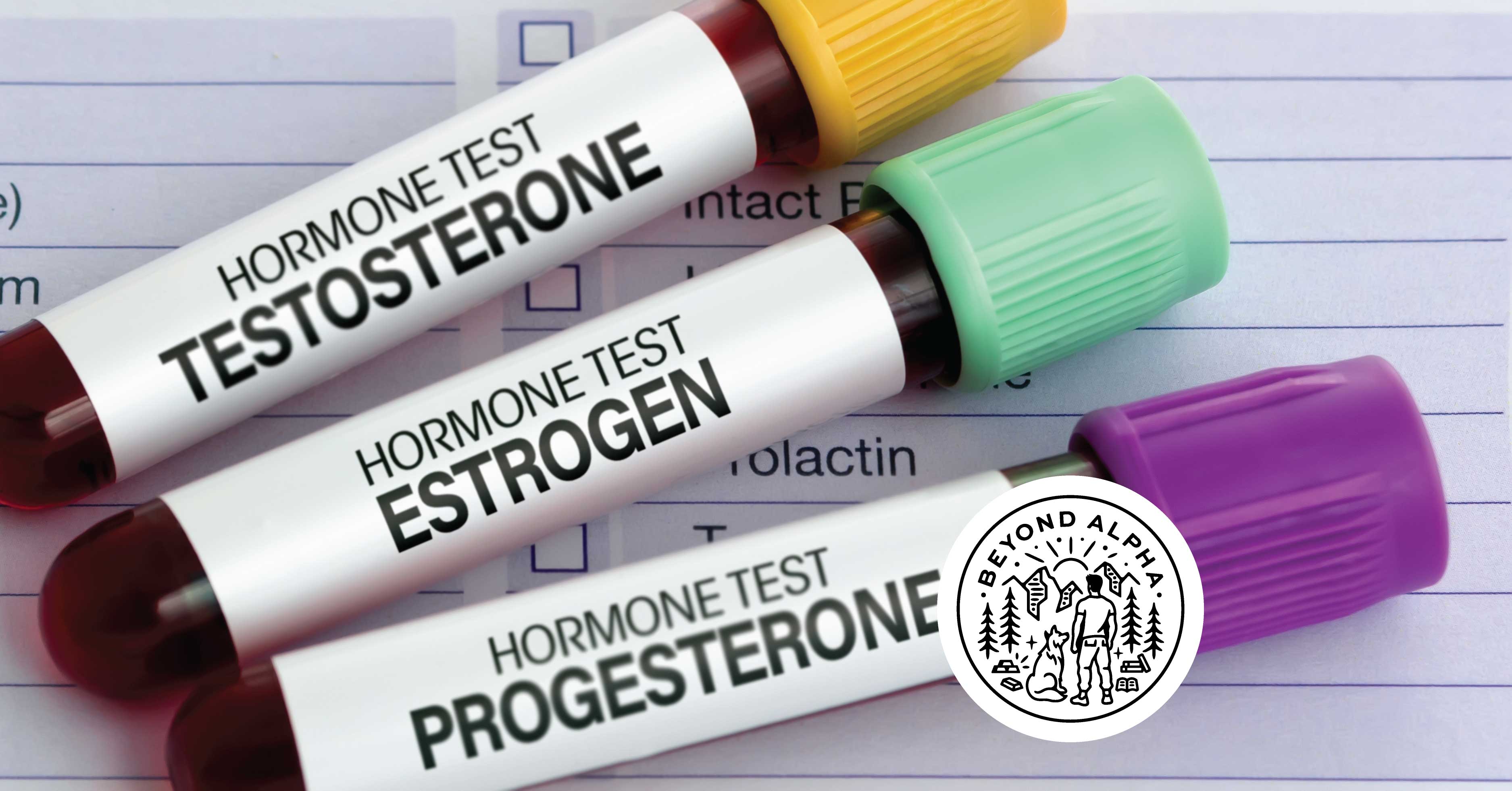 Do Men Have Estrogen? Here’s Why It Matters More Than You Think ...